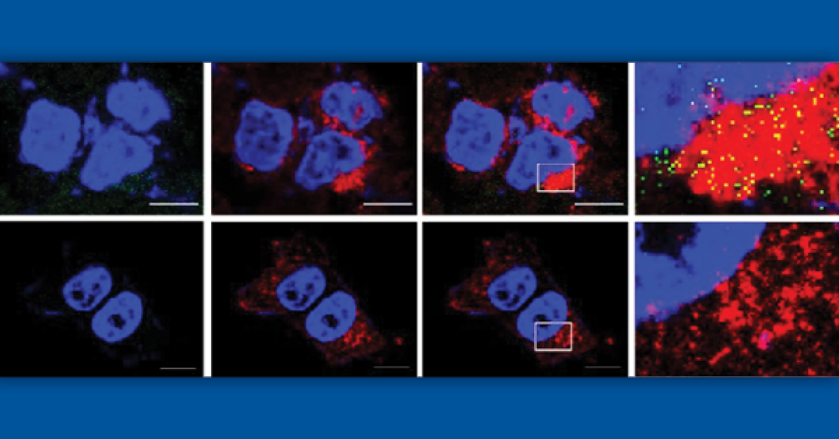 Scientists Hack Cell Entry to Supercharge Cancer Drugs | Giving to Duke ...
